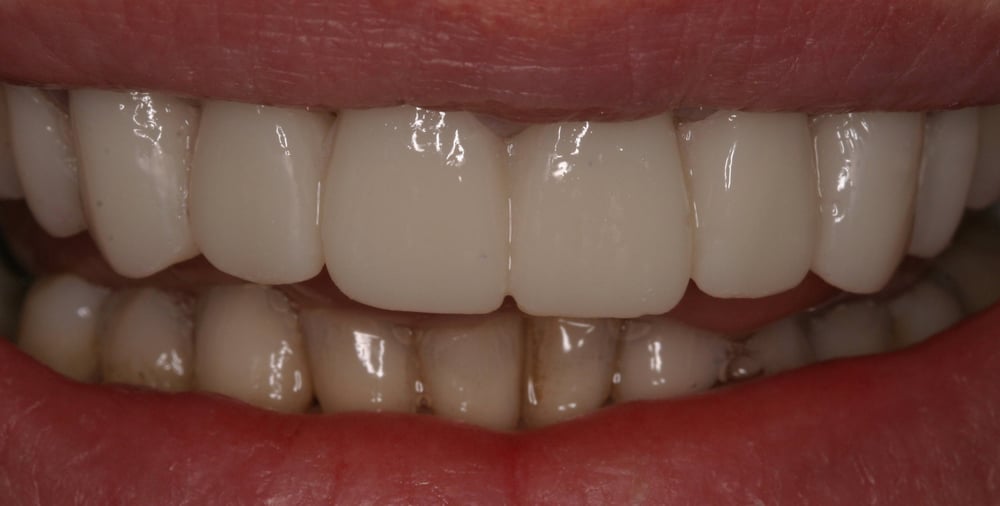 Periodontal and digital dentistry to improve a smile