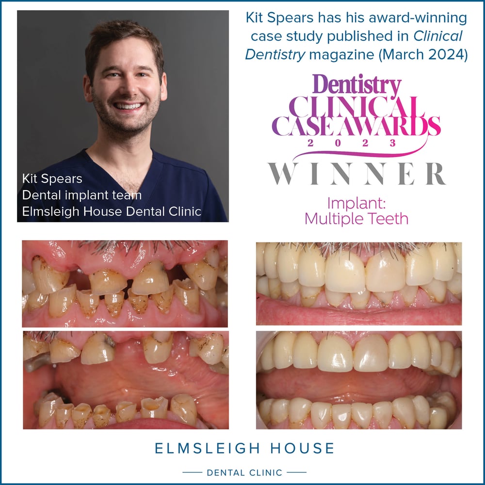 Kit Spears has award-winning dental implant case published