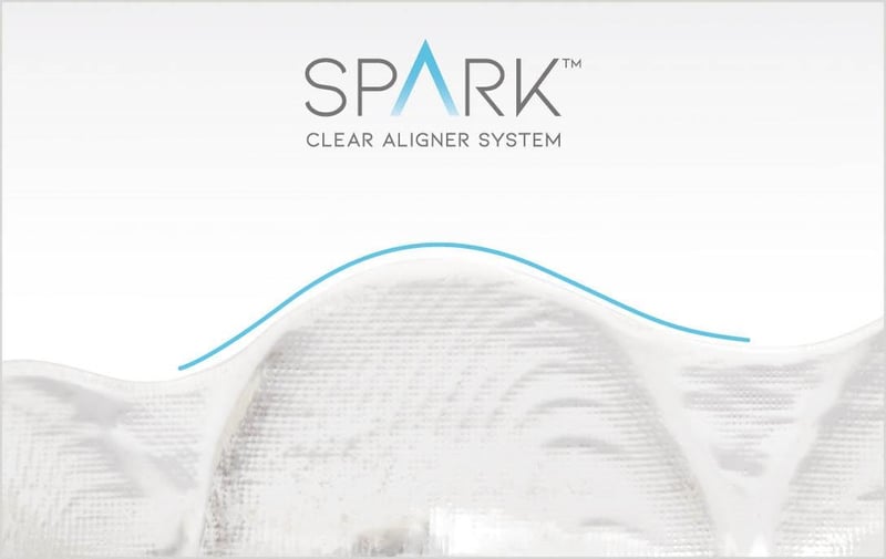 What are the benefits of Spark Aligners?