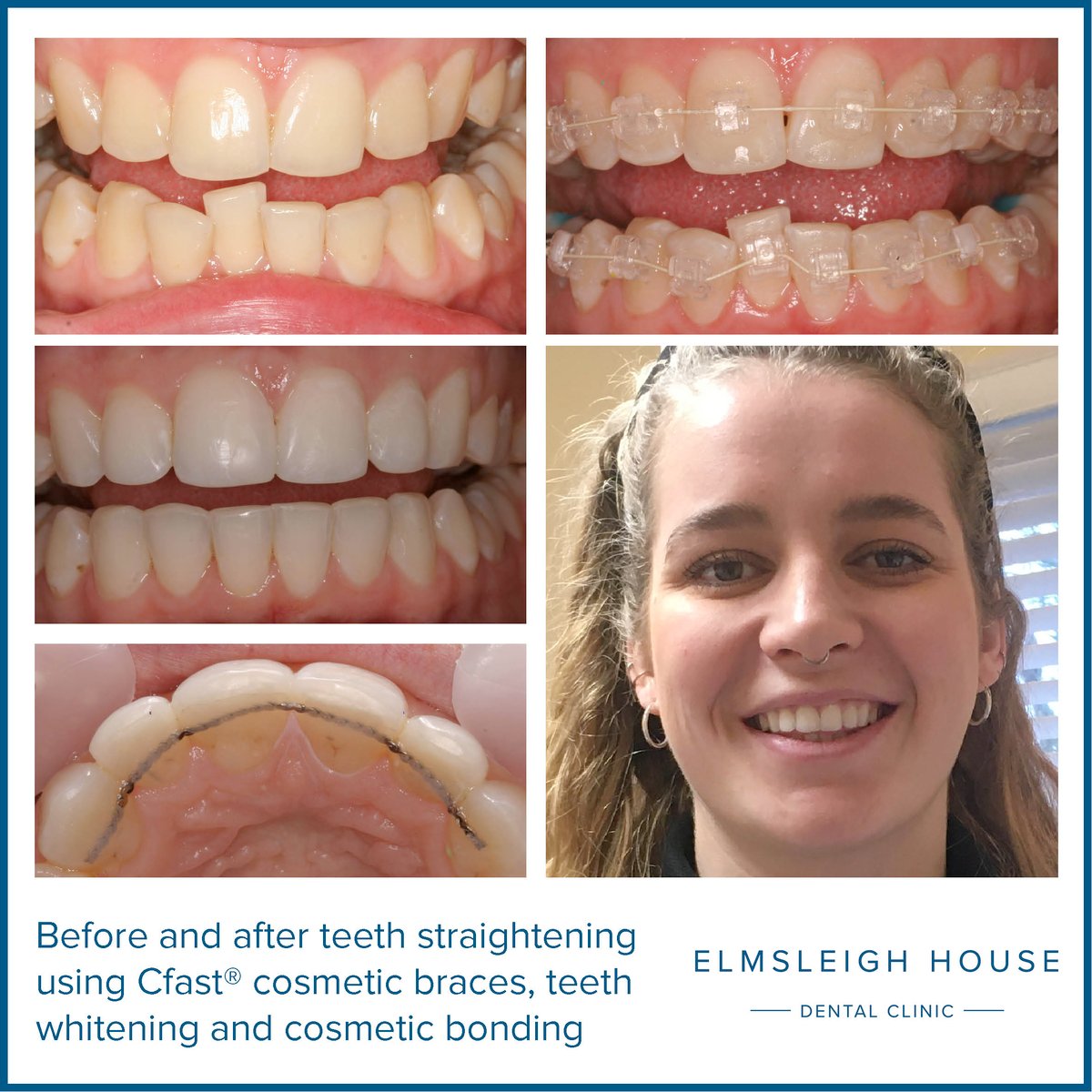 Gallery | Elmsleigh House Dental Clinic